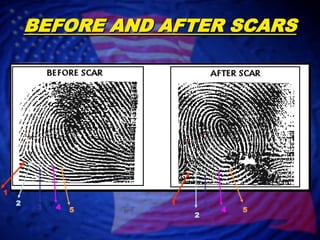 Scarred Patterns | PPT