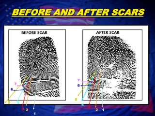 Scarred Patterns | PPT