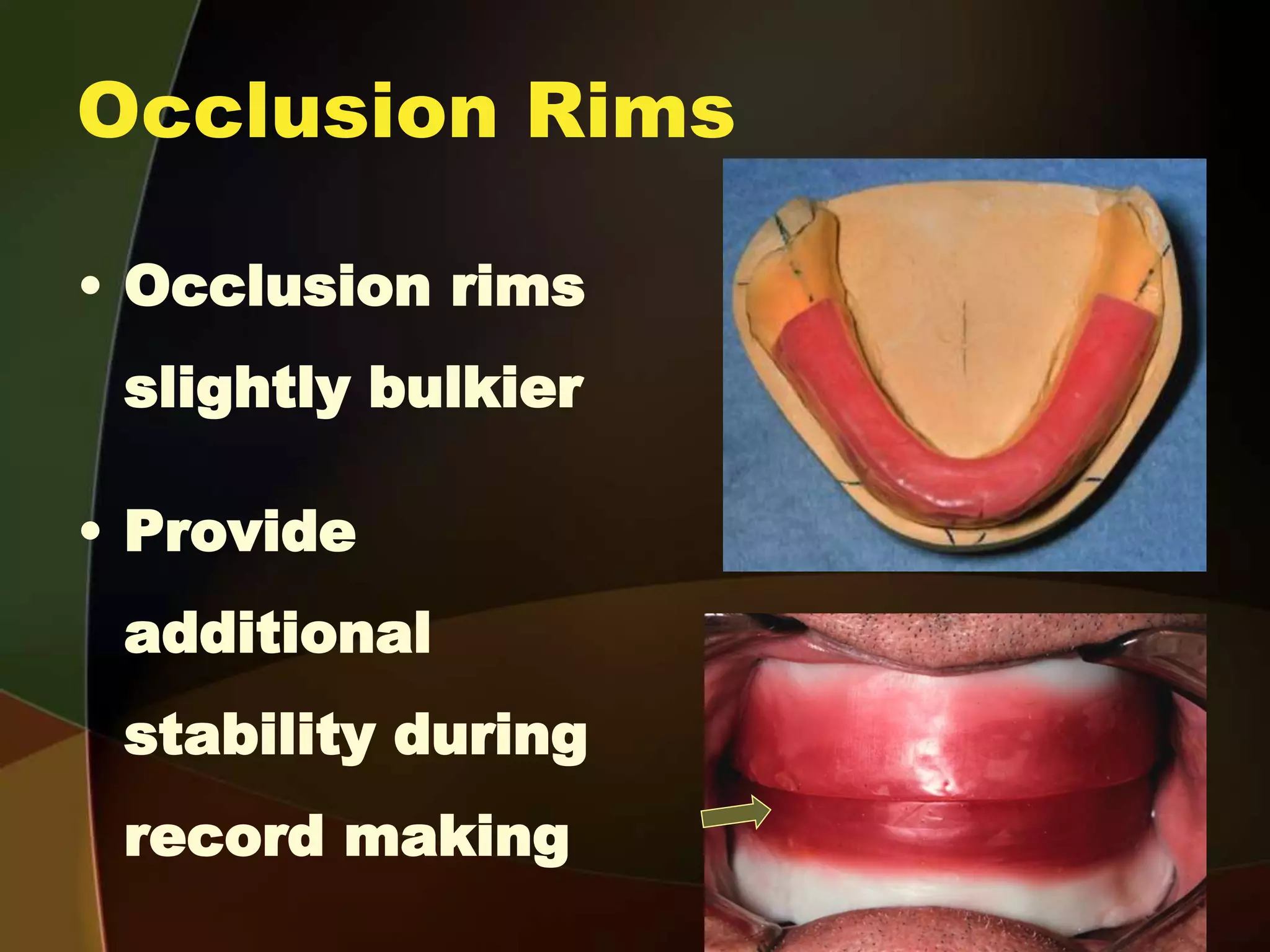 Jaw Relation Record | PPT