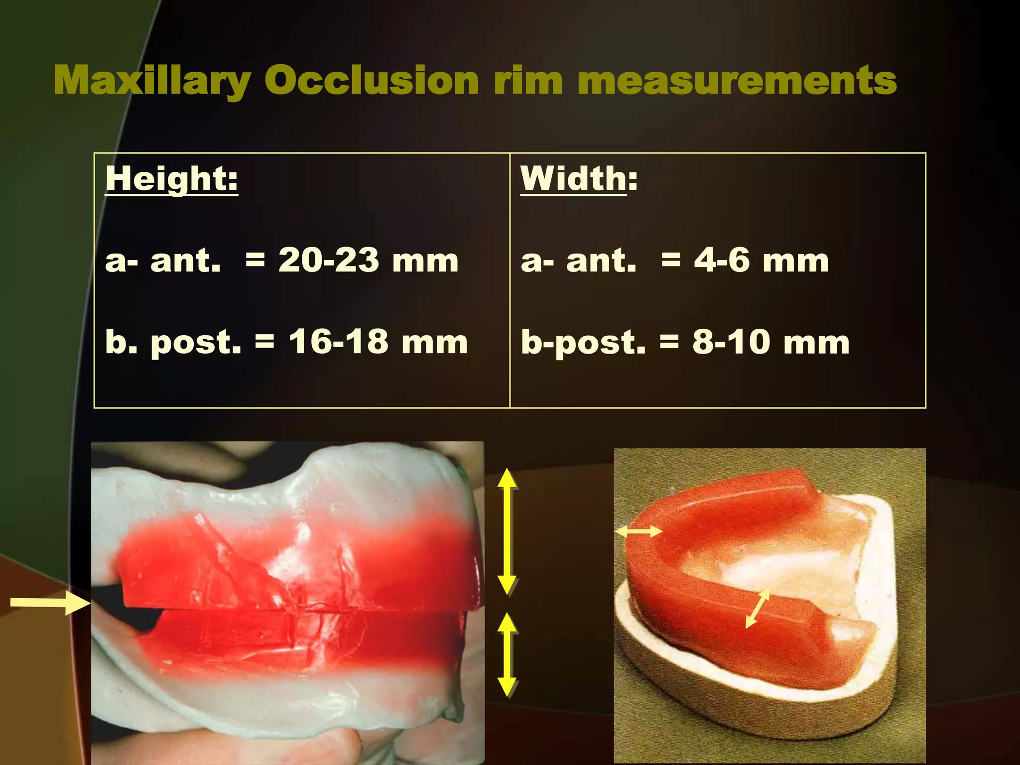 Jaw Relation Record | PPT
