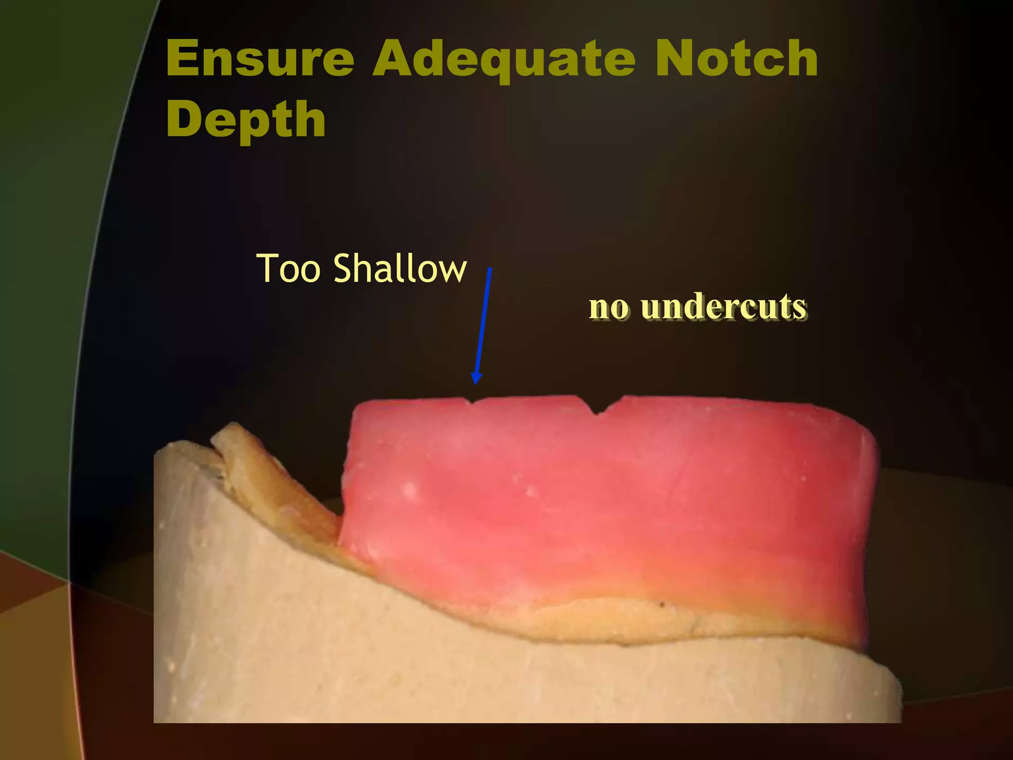 Jaw Relation Record | PPT