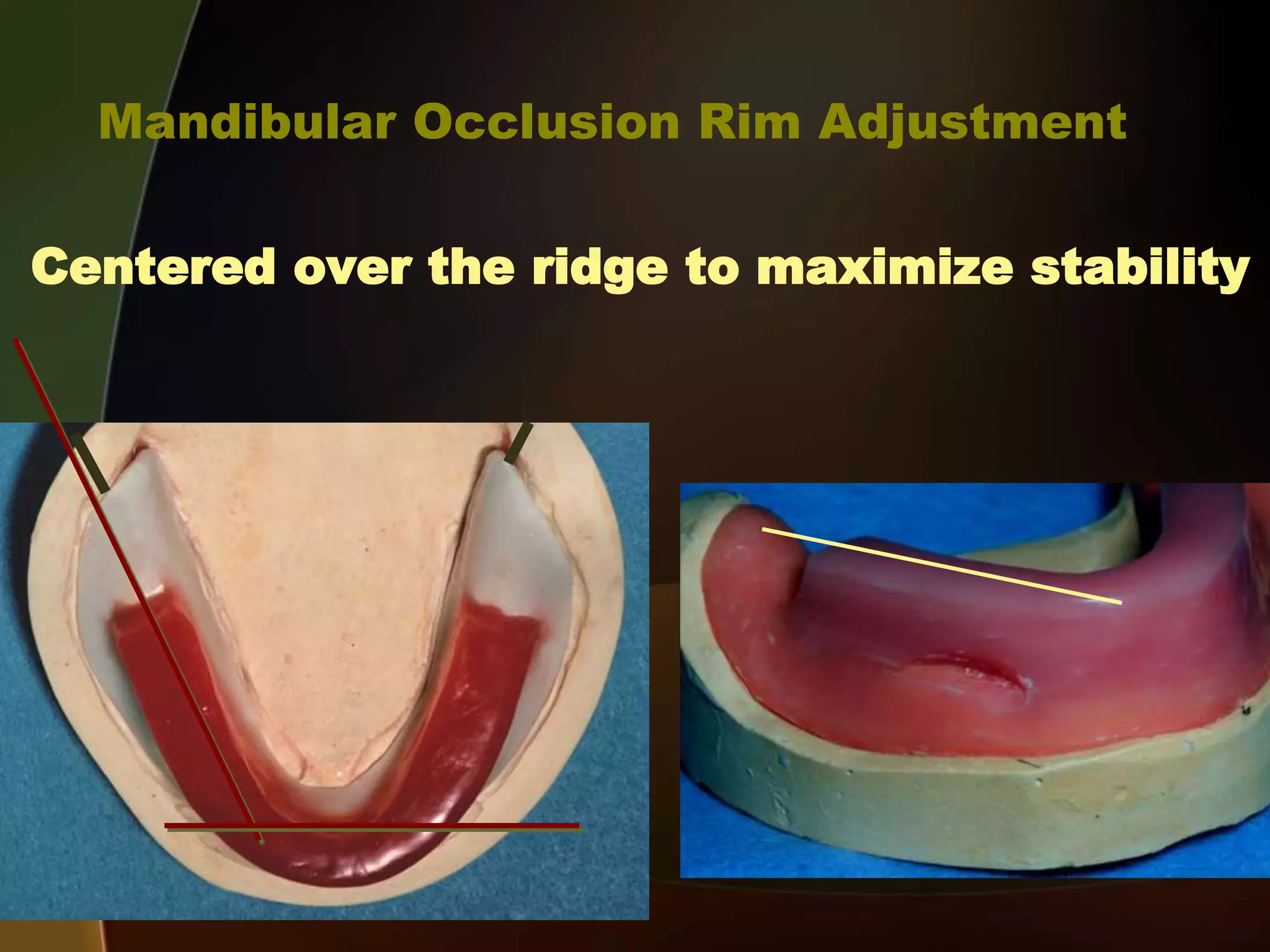 Jaw Relation Record | PPT