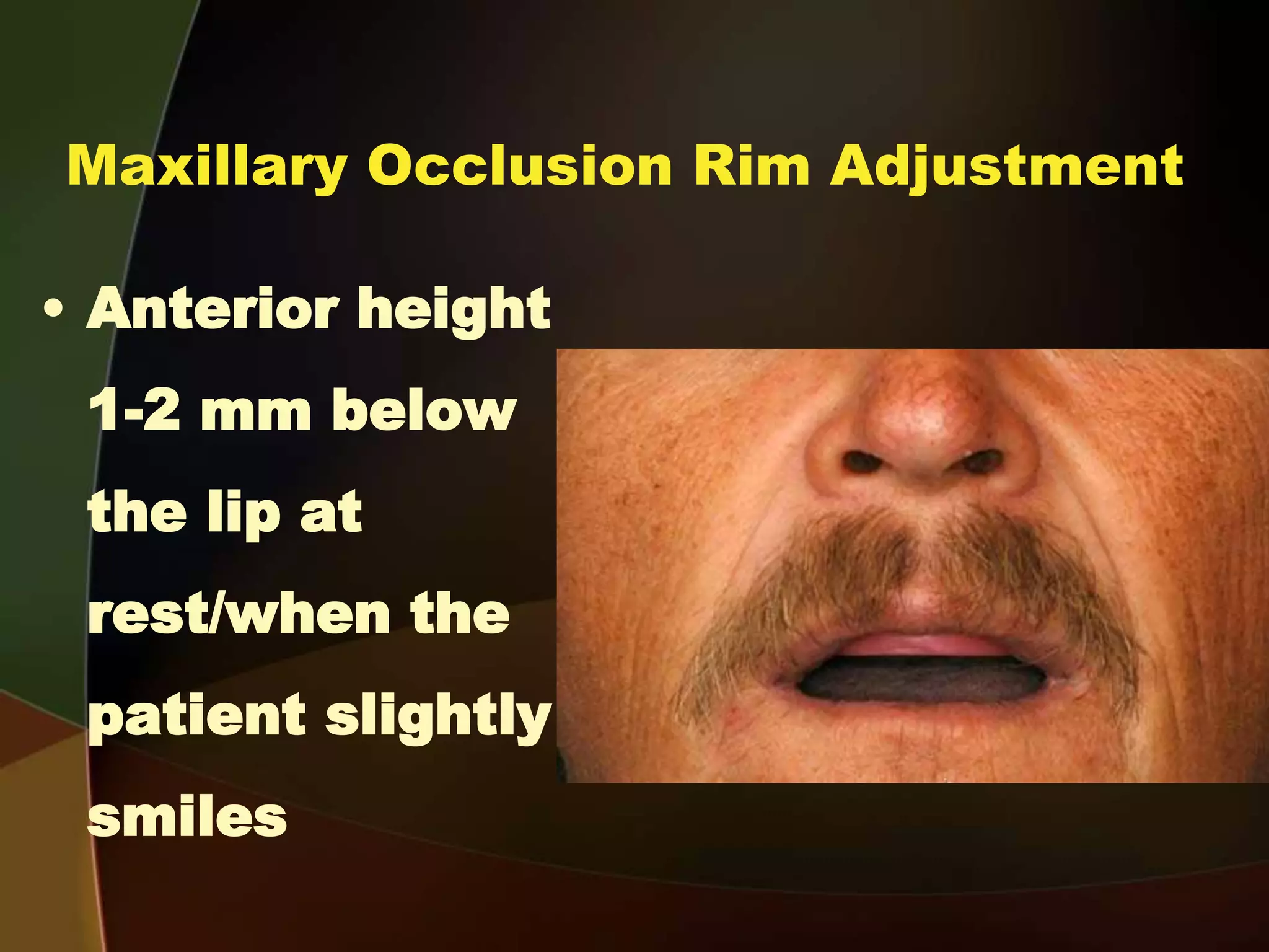 Jaw Relation Record | PPT