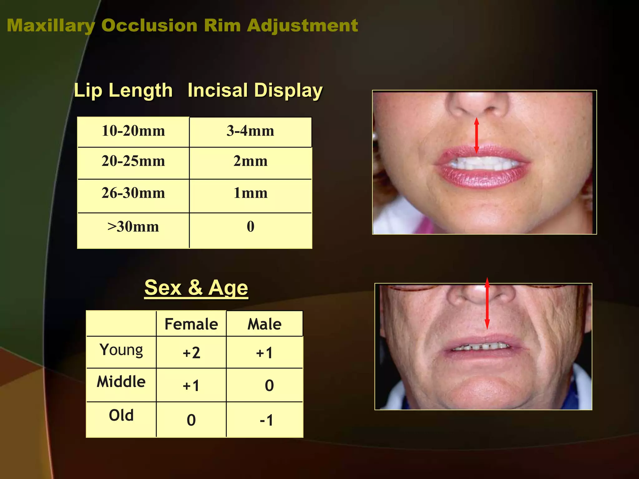 Jaw Relation Record | PPT