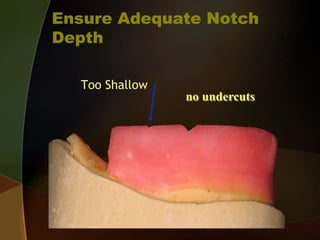 4- b Steps of recording jaw relation for completely edentulous patients ...