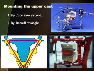 4- b Steps of recording jaw relation for completely edentulous patients ...