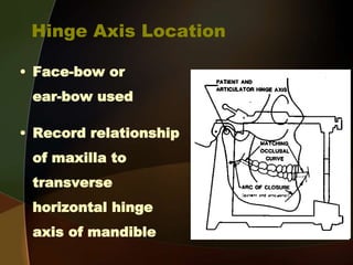 4- b Steps of recording jaw relation for completely edentulous patients ...