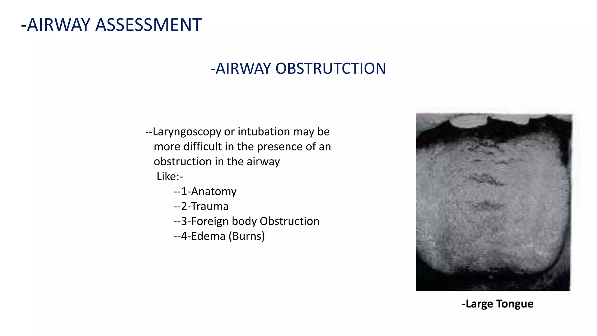 airway assessment part-2-Anesthesia | PDF