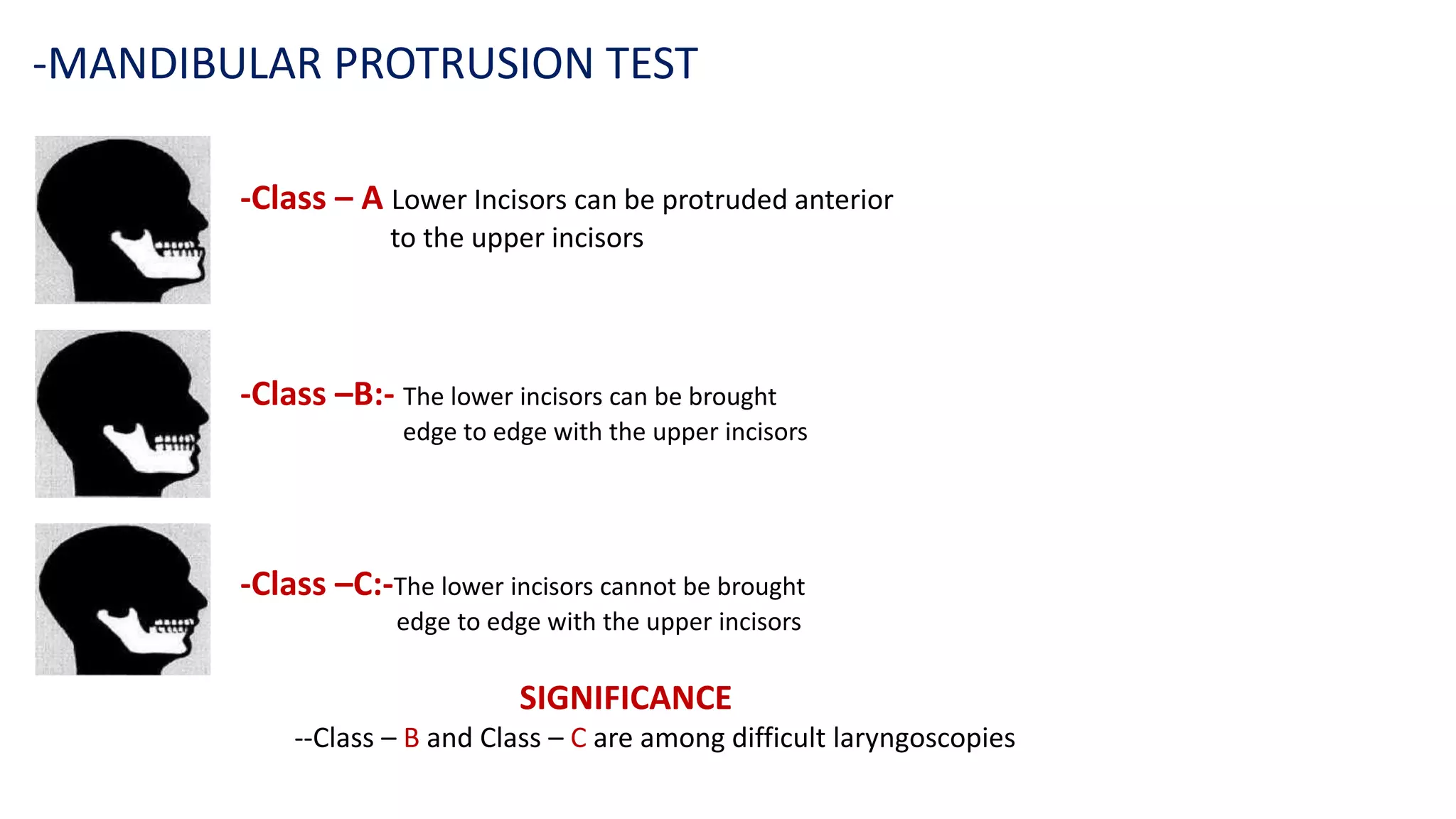 airway assessment part-2-Anesthesia | PDF
