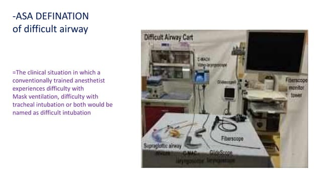 airway assessment part-2-Anesthesia | PDF