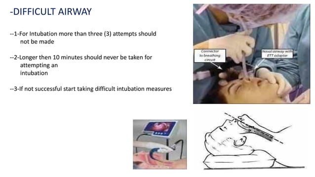 airway assessment part-2-Anesthesia | PDF
