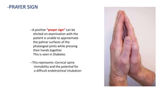 airway assessment part-2-Anesthesia | PDF