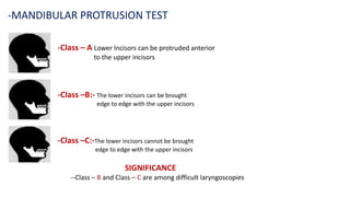 airway assessment part-2-Anesthesia | PPT