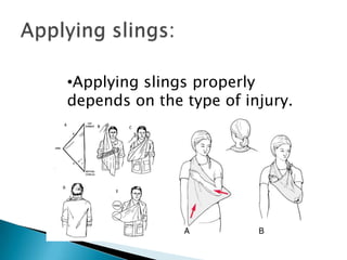 4 bandages and slings | PPT