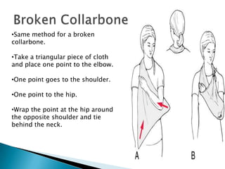 4 bandages and slings | PPTX