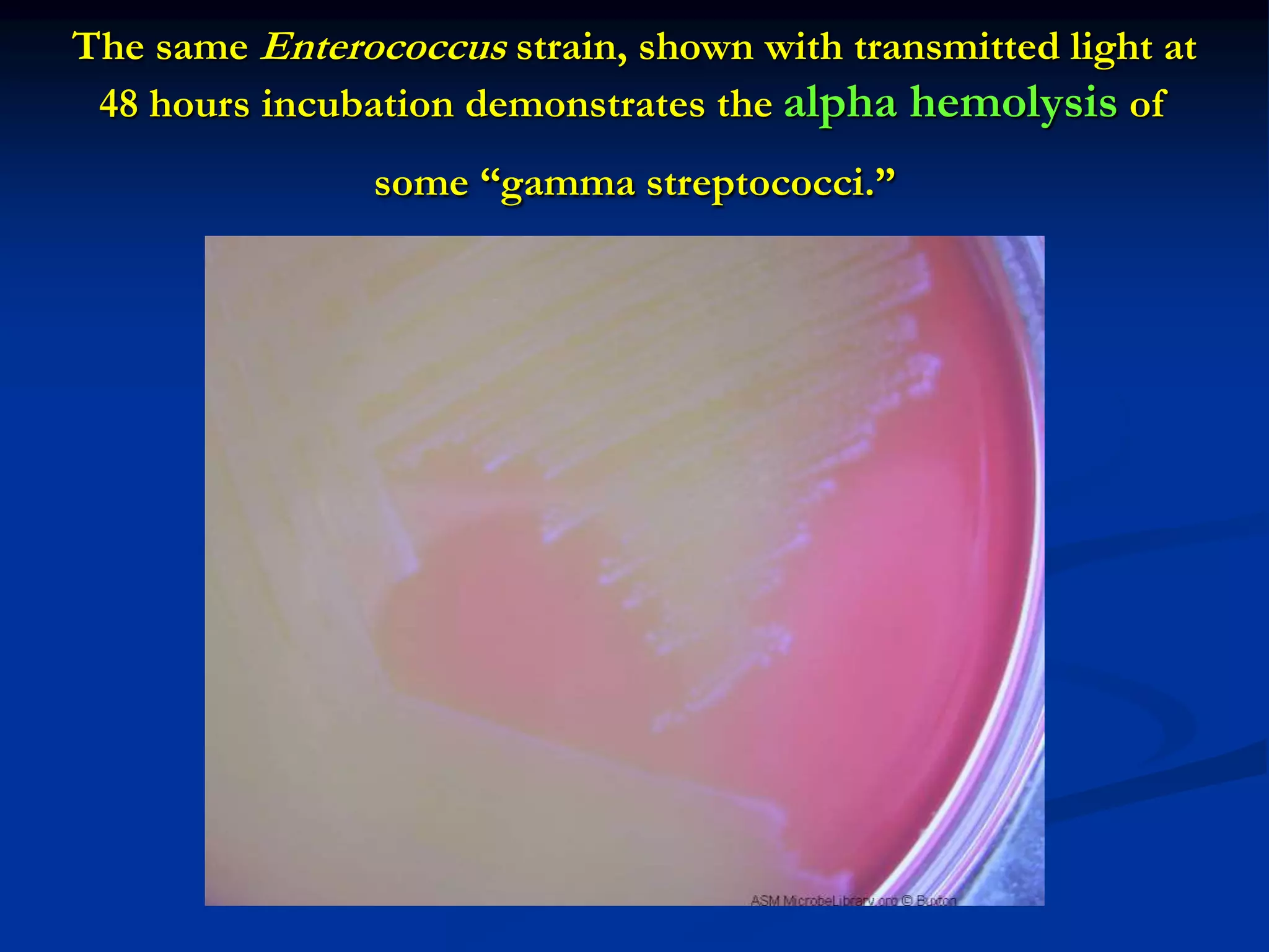 4 blood agar and hemolysis and mac-conkey.ppt