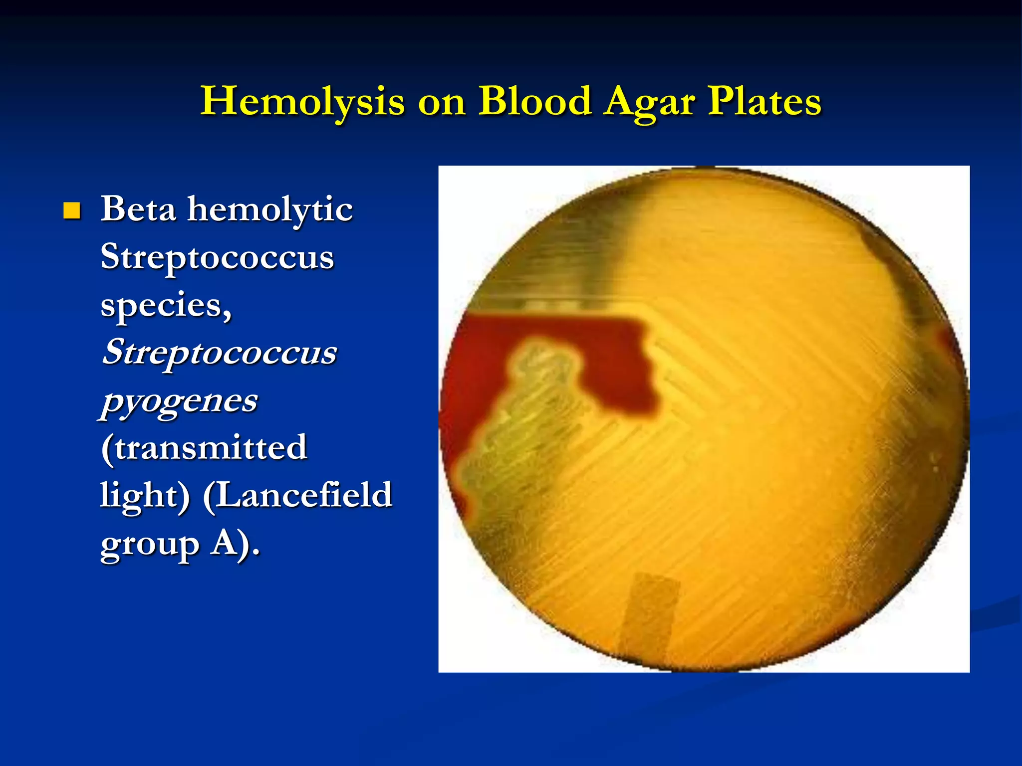 4 blood agar and hemolysis and mac-conkey.ppt