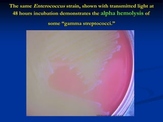 4 blood agar and hemolysis and mac-conkey.ppt