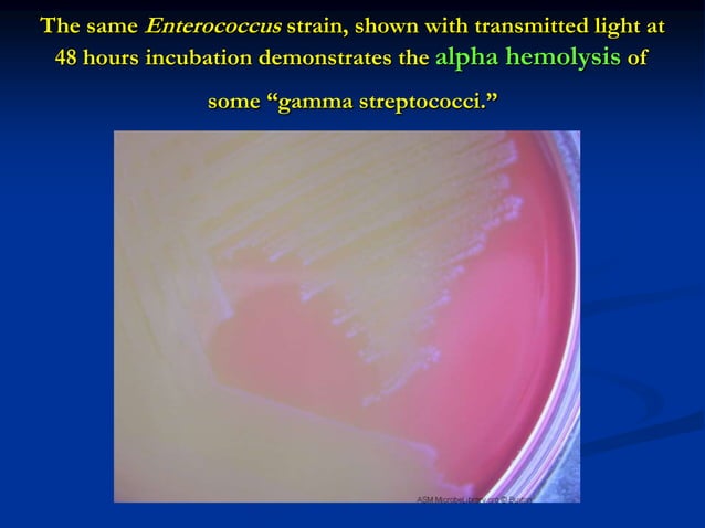 4 blood agar and hemolysis and mac-conkey.ppt