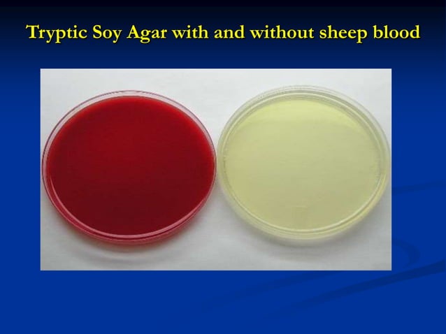 4 blood agar and hemolysis and mac-conkey.ppt