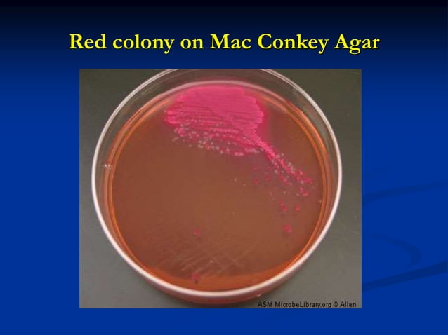 4 blood agar and hemolysis and mac-conkey.ppt