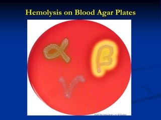 4 blood agar and hemolysis and mac-conkey.ppt