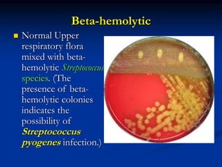 4 blood agar and hemolysis and mac-conkey.ppt