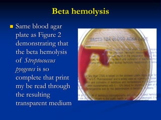 4 blood agar and hemolysis and mac-conkey.ppt