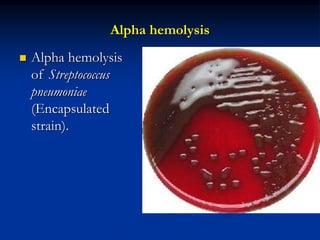 Blood Agar Alpha Hemolysis