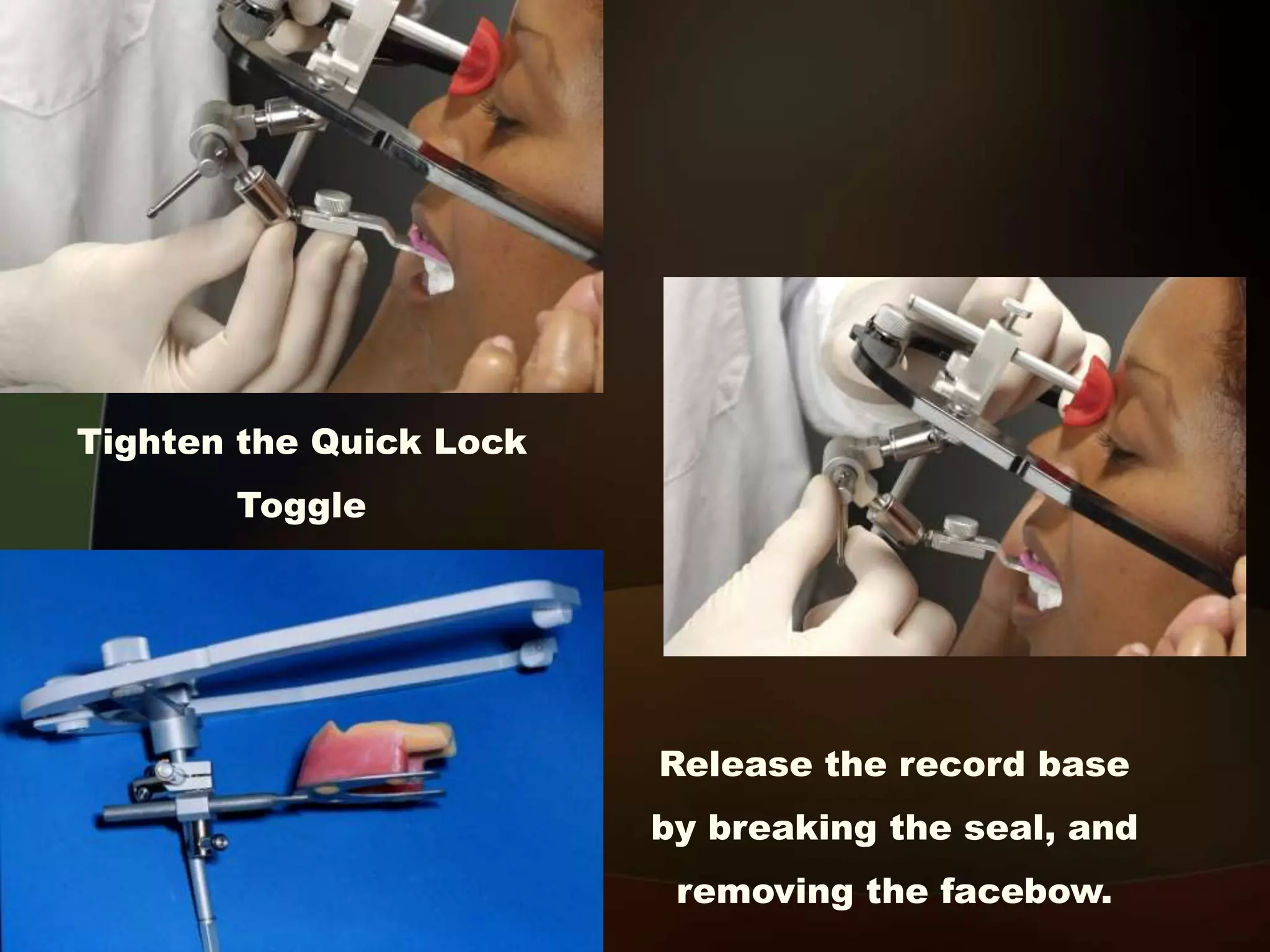 4. c- Face Bow Record | PPT