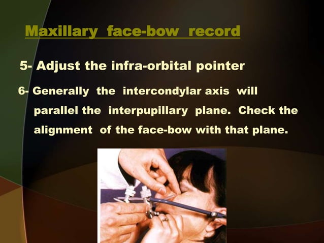4. c- Face Bow Record | PPT | Dental Health | Diseases and Conditions