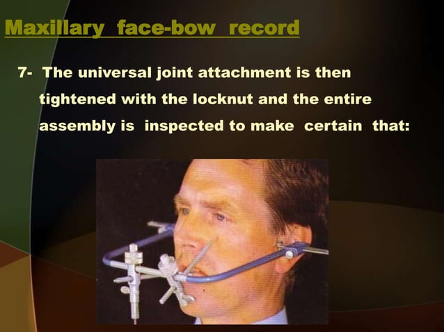 4. c- Face Bow Record | PPT | Dental Health | Diseases and Conditions