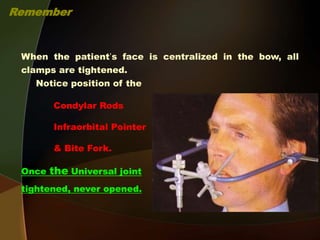 4. c- Face Bow Record | PPT