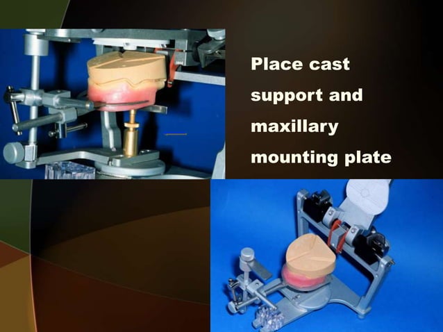 4. c- Face Bow Record | PPT | Dental Health | Diseases and Conditions