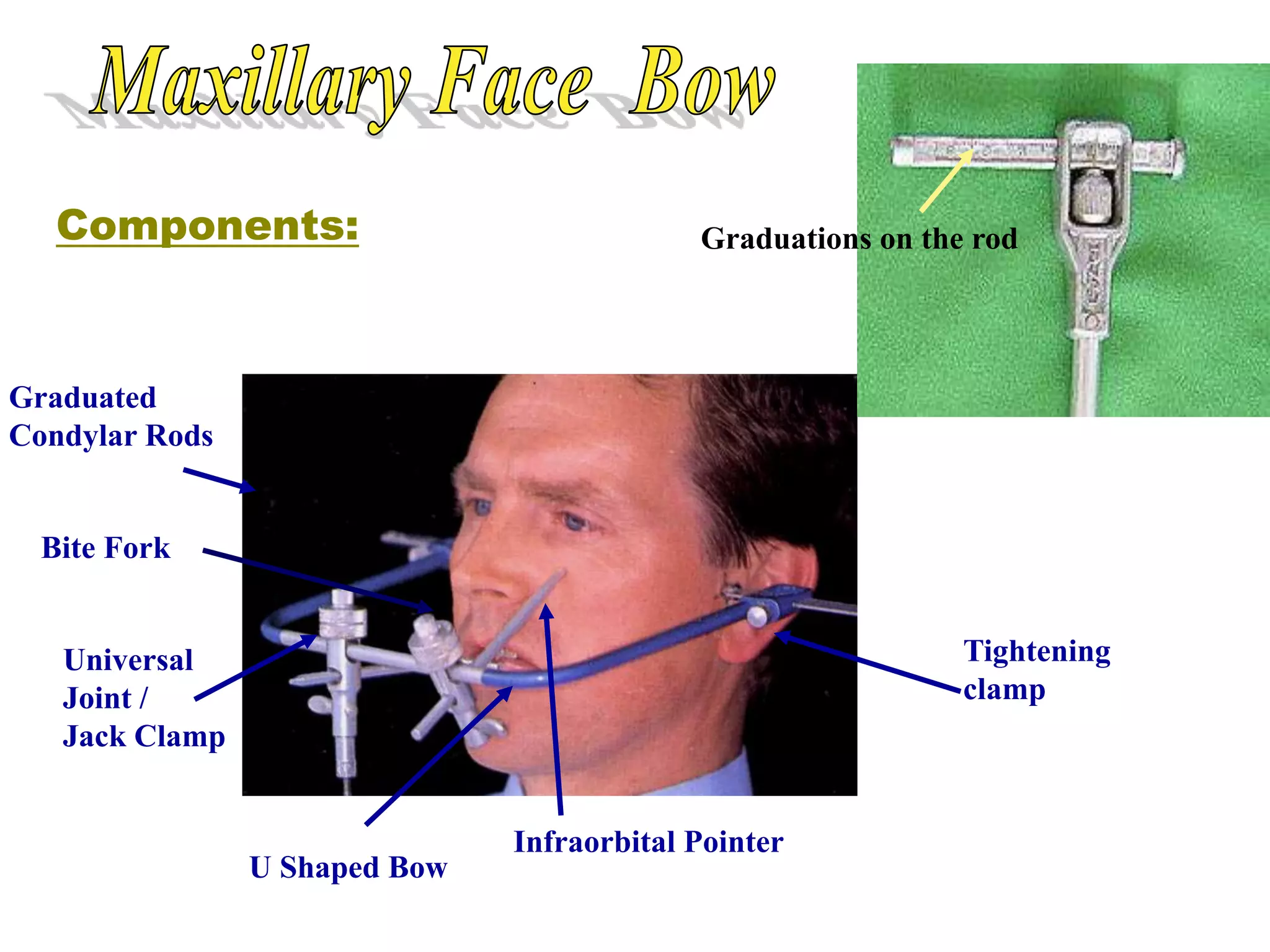 4- c Maxillo-mandibular Relation Records -Face bow record and transfer ...