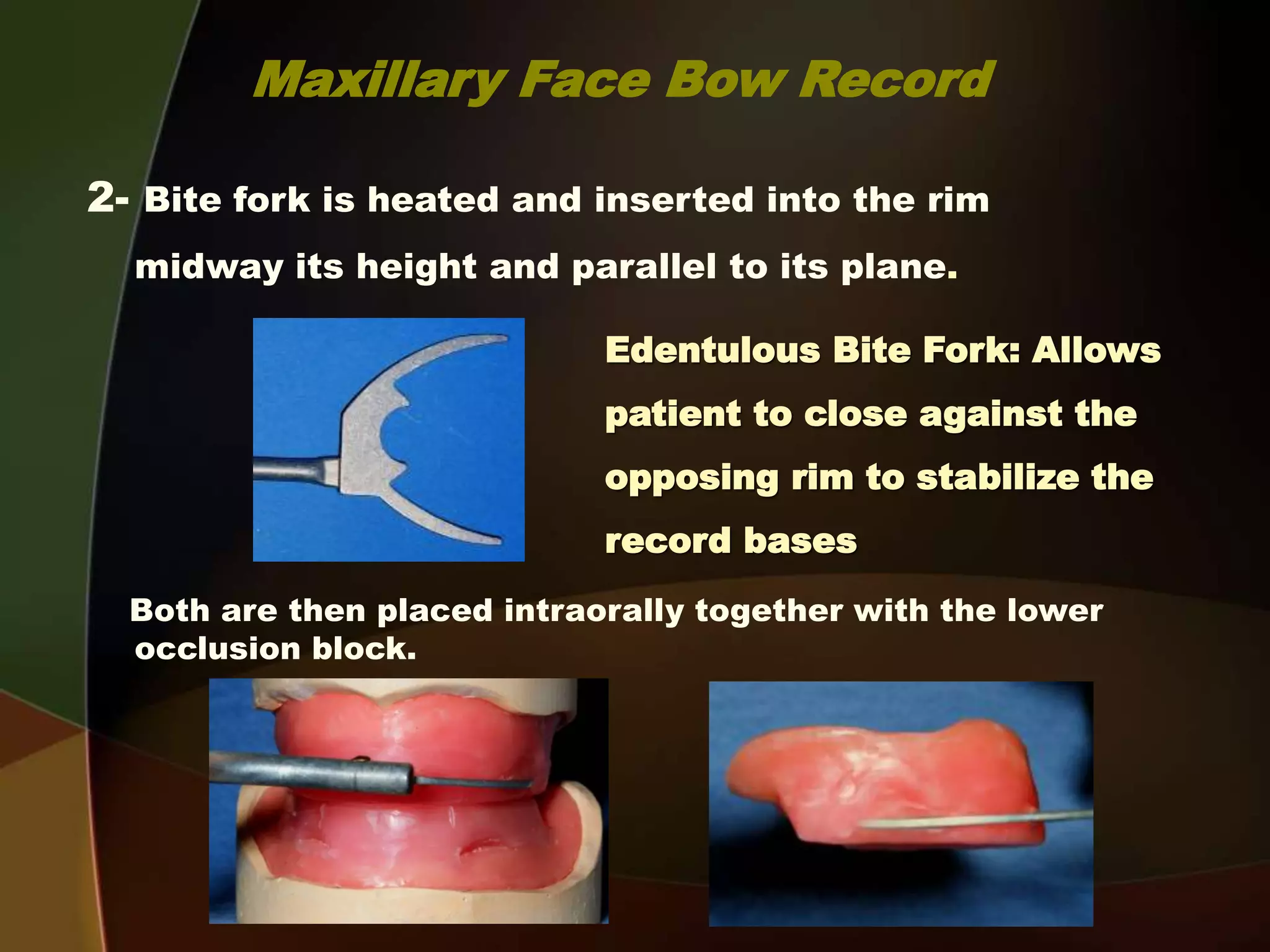 4- c Maxillo-mandibular Relation Records -Face bow record and transfer ...