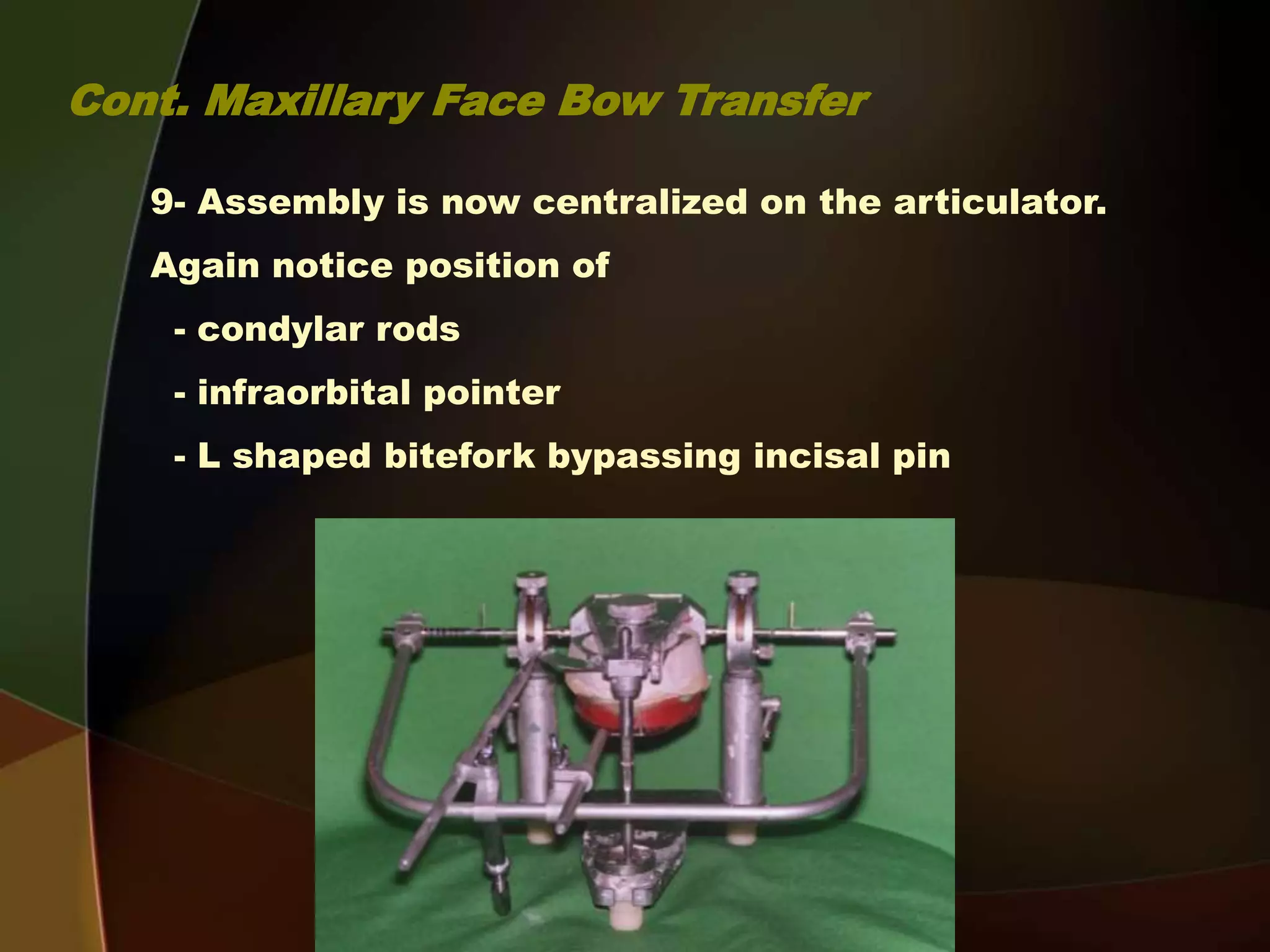 4- c Maxillo-mandibular Relation Records -Face bow record and transfer ...