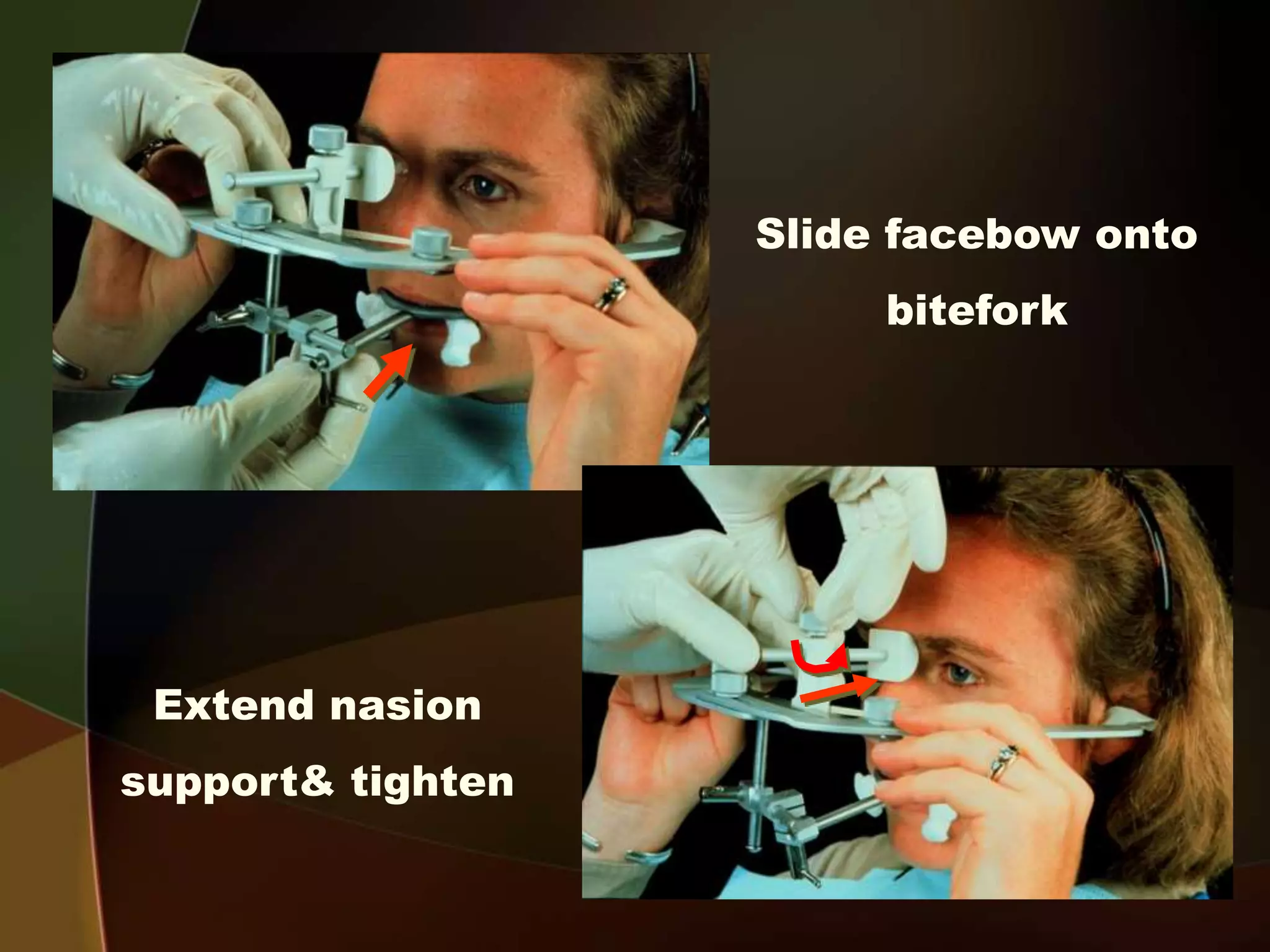 4- c Maxillo-mandibular Relation Records -Face bow record and transfer ...