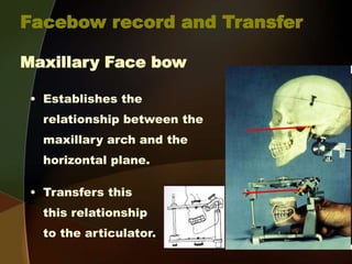 4- c Maxillo-mandibular Relation Records -Face bow record and transfer ...