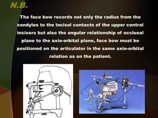 4- c Maxillo-mandibular Relation Records -Face bow record and transfer ...