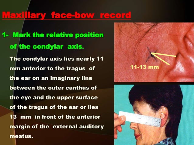4- c Maxillo-mandibular Relation Records -Face bow record and transfer ...