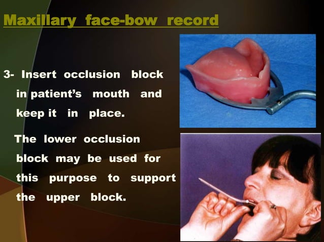4- c Maxillo-mandibular Relation Records -Face bow record and transfer ...