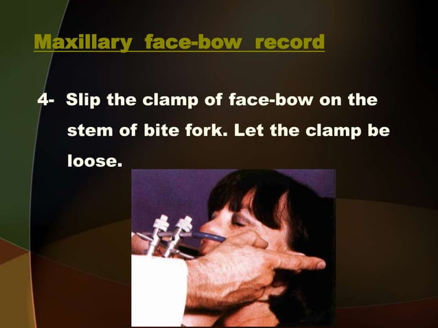 4- c Maxillo-mandibular Relation Records -Face bow record and transfer ...