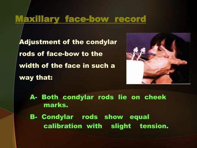 4- c Maxillo-mandibular Relation Records -Face bow record and transfer ...