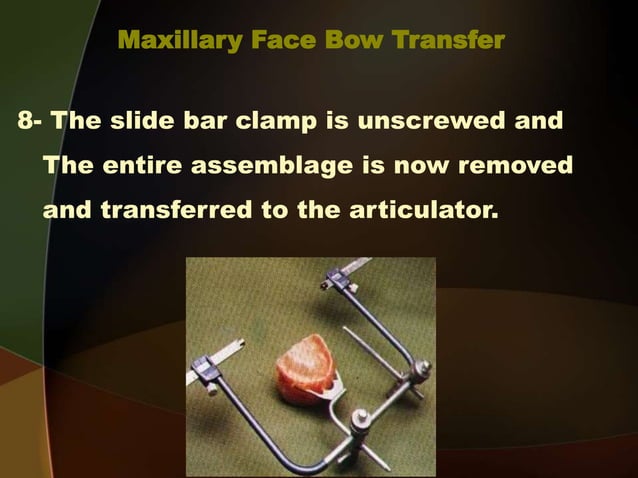 4- c Maxillo-mandibular Relation Records -Face bow record and transfer ...