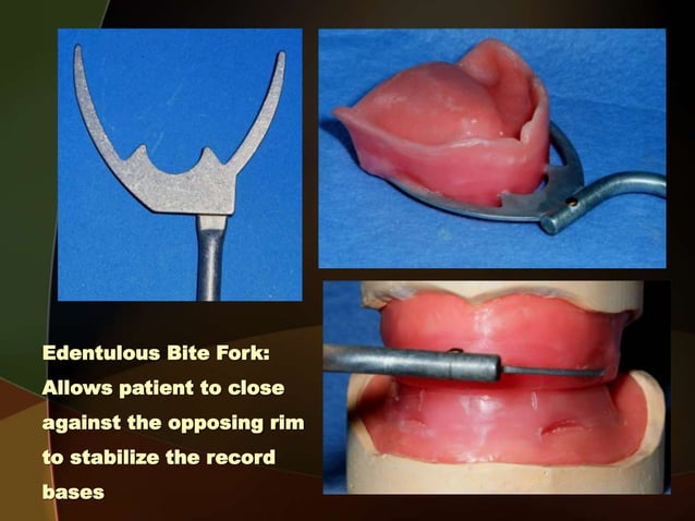 4- c Maxillo-mandibular Relation Records -Face bow record and transfer ...