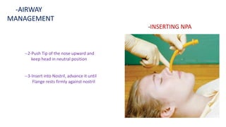 airway management part-3.-Anesthesia | PPT