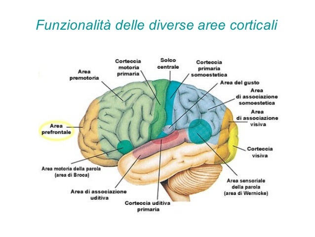 Cervello