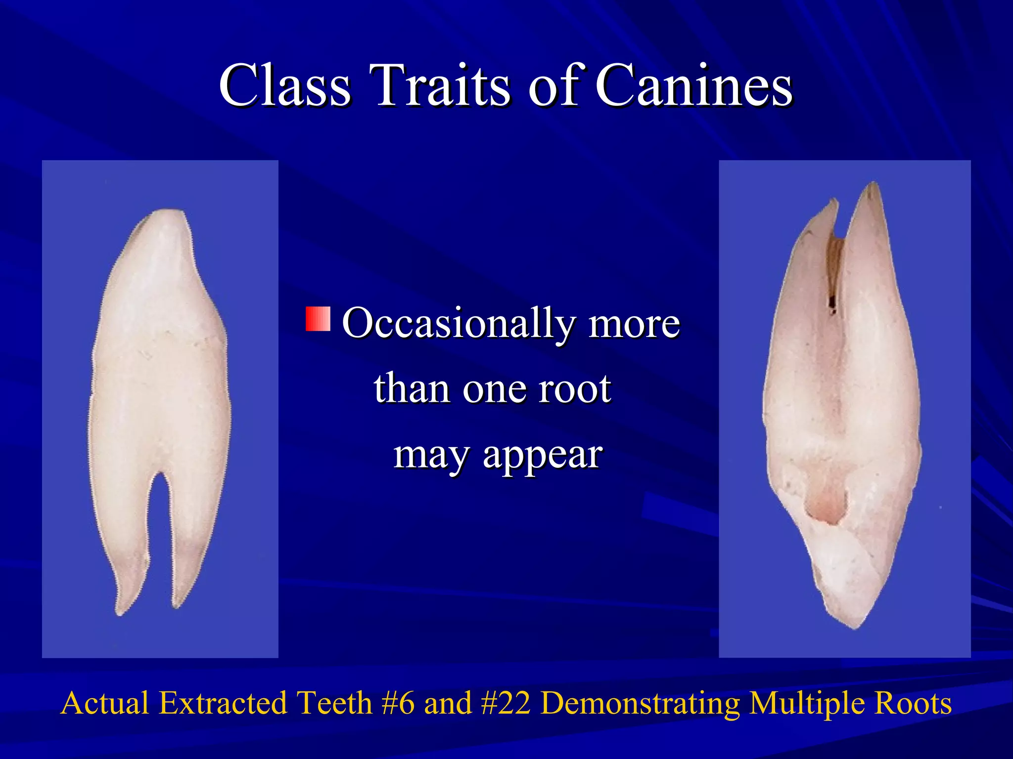 Maxillary and Mandibular Canines | PPT
