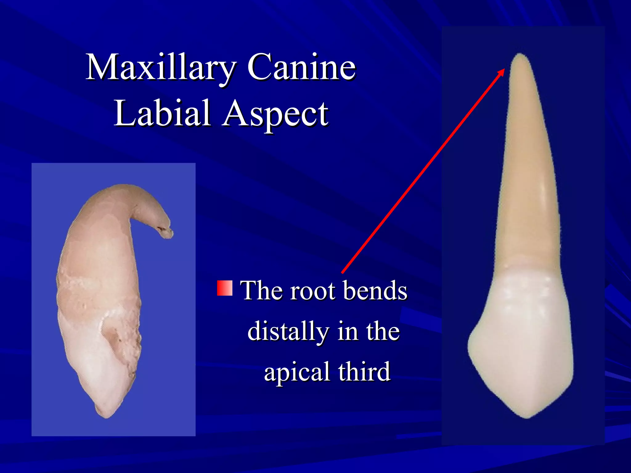 Maxillary and Mandibular Canines | PPT